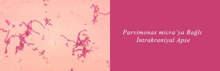 Parvimonas micra’ya Bağlı İntrakraniyal Apse | Klimik