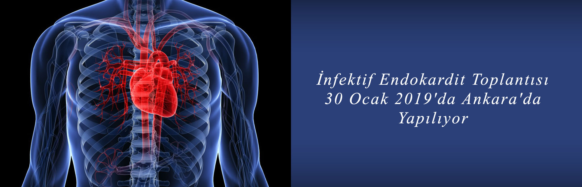 İnfektif Endokardit Toplantısı 30 Ocak 2019’da Ankara’da Yapılıyor | Klimik