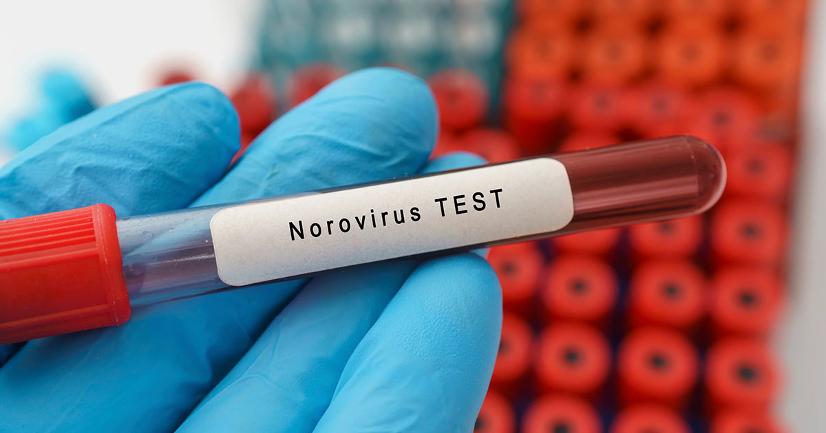 CDC Verilerine Göre Yüksek Derecede Bulaşıcı Norovirus Olguları Bu ...